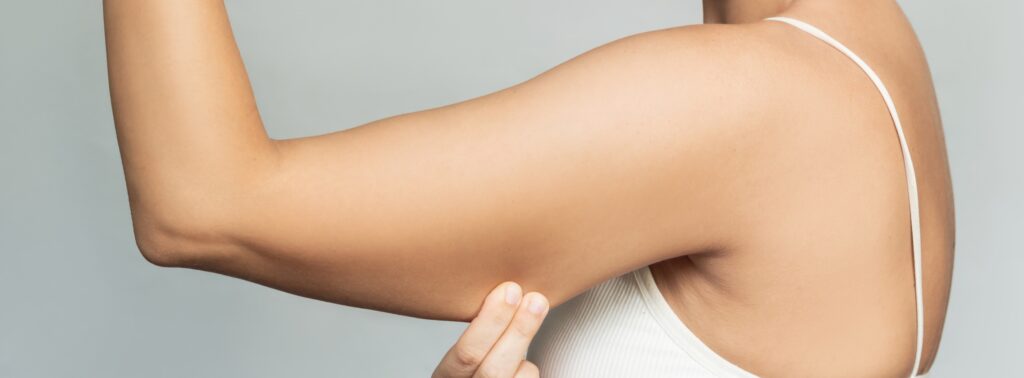 Peau Fripée des Bras : Comment Retendre la Peau et Retrouver des Bras Fermes ? | Dr Santini